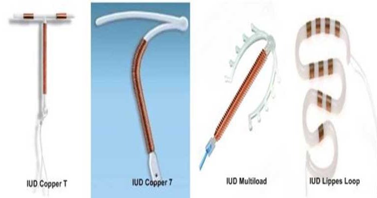 KB Spiral (IUD) untuk Wanita - Ilmu Kebidanan