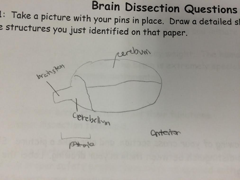 Anatomy and Beyond: Brain Dissection Analysis