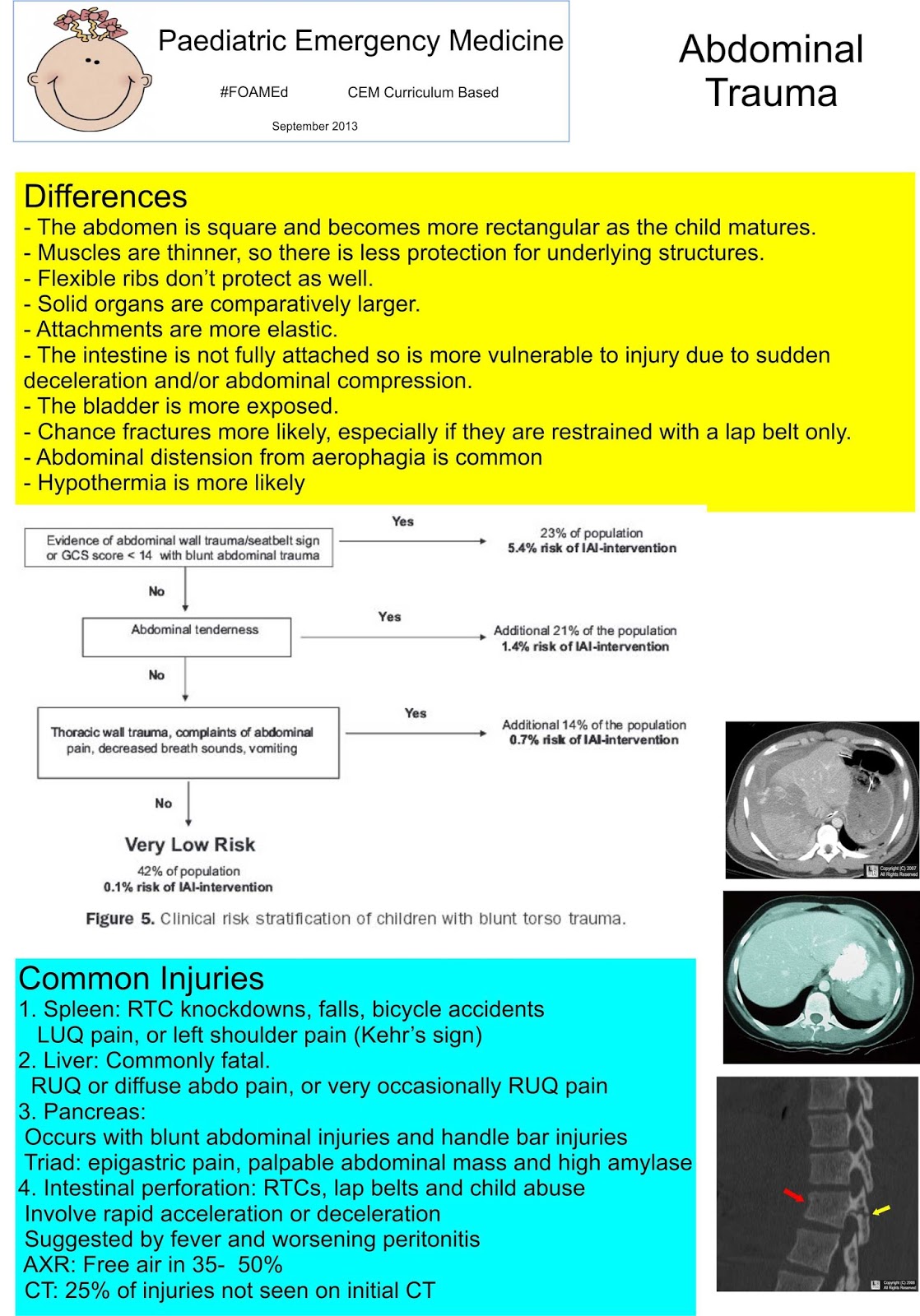 Paediatric Emergency Medicine: PMP4: Major Trauma in Children