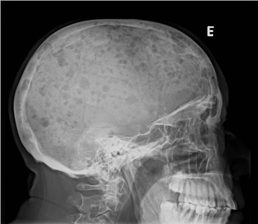 DICAS DE RADIOLOGIA - Tudo Sobre Radiologia: DOENÇAS E PATOLOGIAS ...