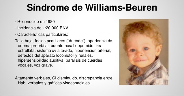 El Síndrome De Williams Libertad De Expresión Yucatán Ley