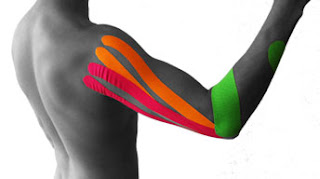 ARES Kinesiology Tape: Tennis Elbow