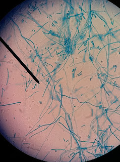 Rincón de Micología: Geotrichum sp.