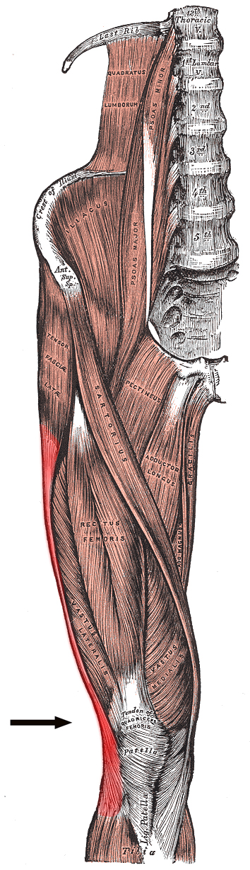 Injury Series: Biomechanical solutions for iliotibial band syndrome ...