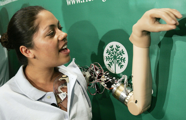 The First Woman to have a Bionic Arm which Controls with a Mind ...