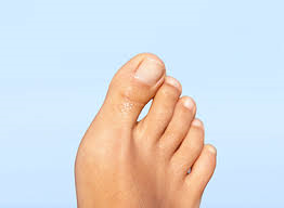 Lo SciacquaLingua: Come si chiamano le dita dei piedi?