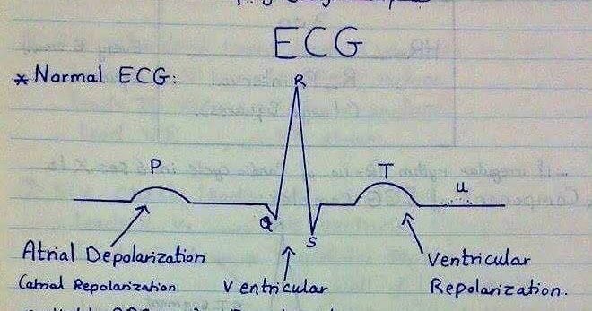 ال ECG في 22 صفحة