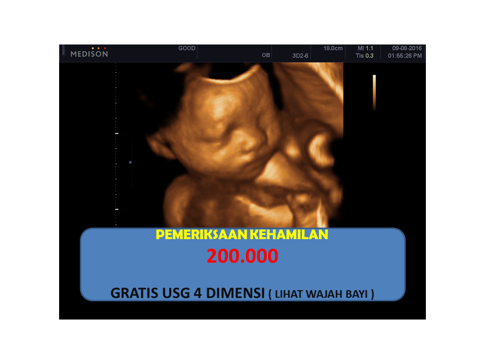 USG 4 DIMENSI: Lengkap Tentang USG 2 Dimensi, 3 Dimensi dan 4 Dimensi