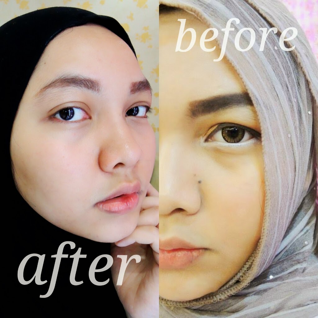 Kulit Kusam Bisa Bersih Dalam Sekejap ~ Theraskin Care Kosmetik