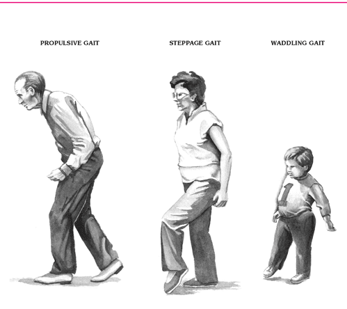 Un Paso Adelante: Marcha en Stepagge