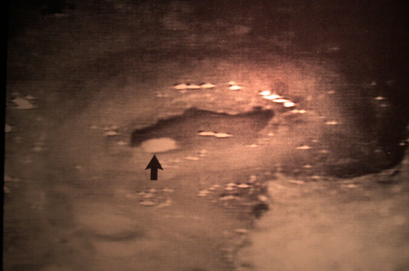 VERTIGEM POSICIONAL PAROXÍSTICA BENIGNA: VPPB