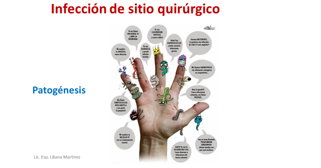 Prevencion de Infeccion de sitio quirugico