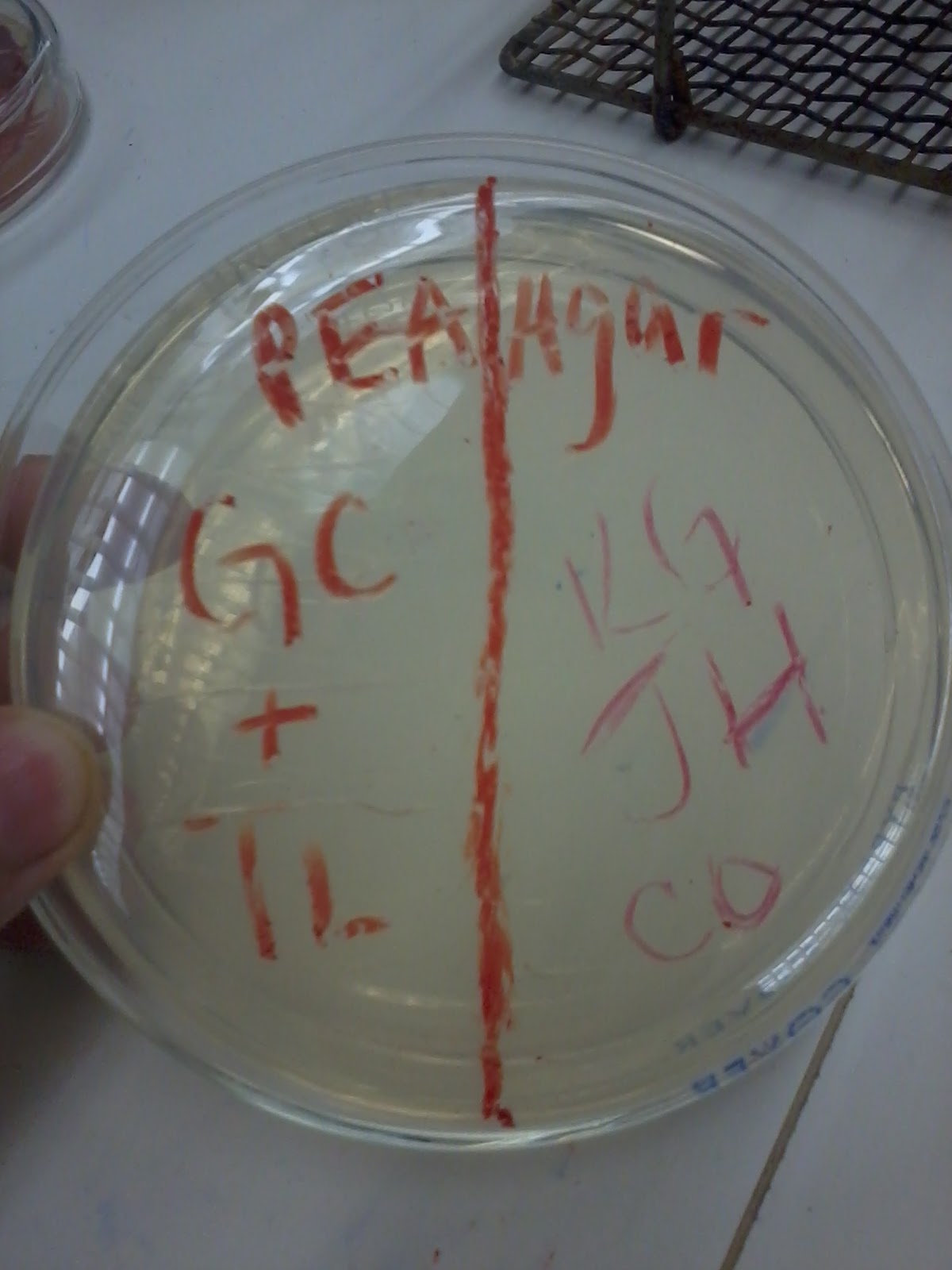 "G"O"T" Micro?: Day 10 - Urea, Differential Plates, PEA, NItrate ...