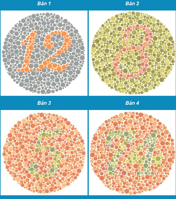 Trung Tâm Mắt Hải Yến: Kiểm tra về bệnh mù màu