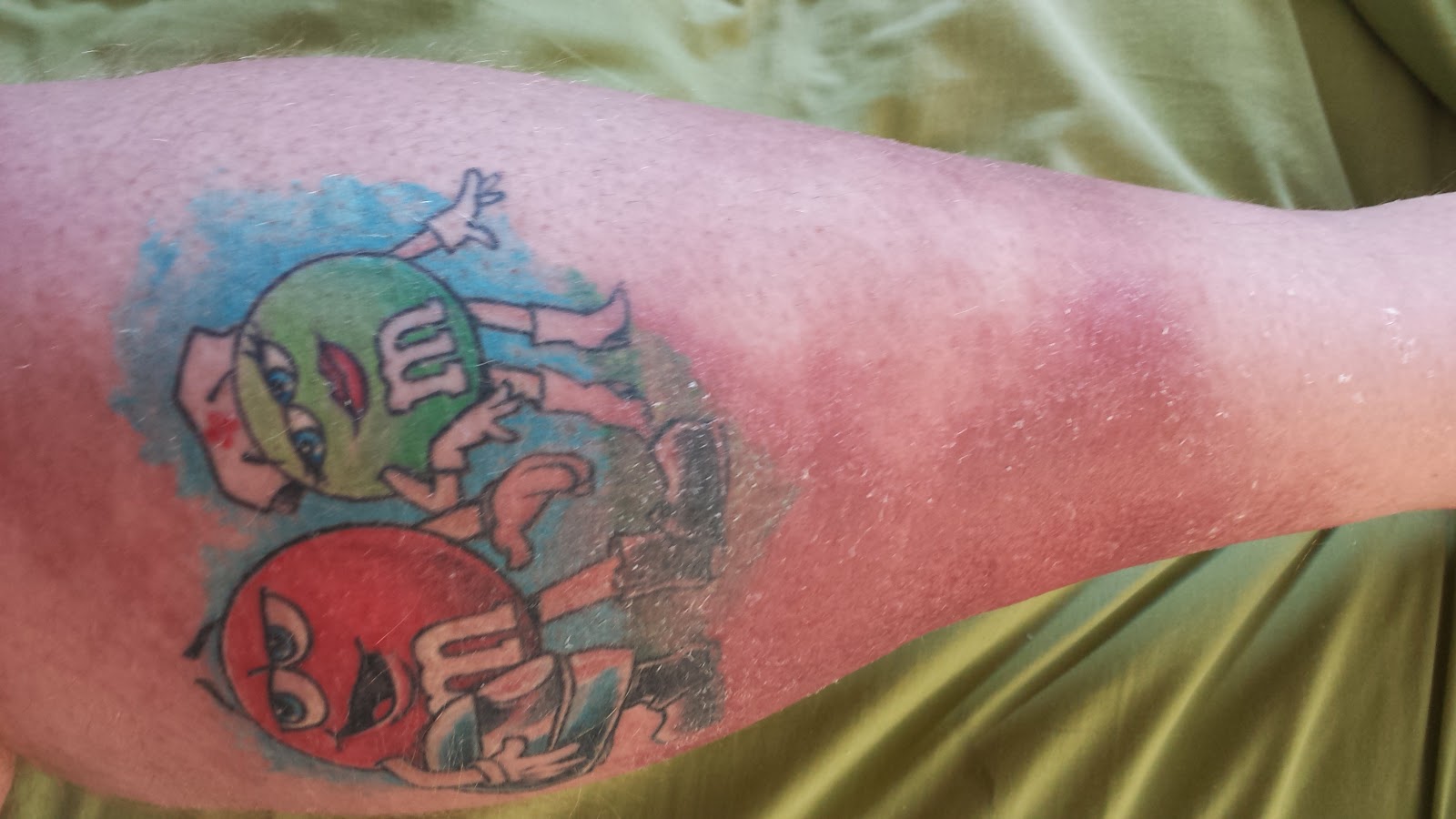 BubbaMike's Ramblings: Cellulitis (warning, graphic photos in this post)