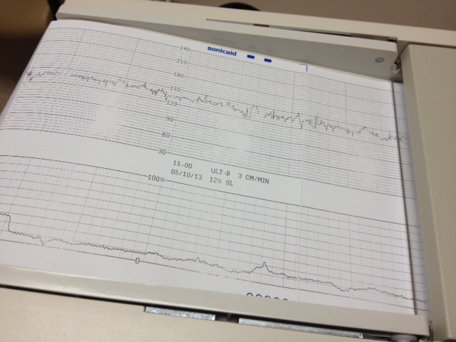 Marianne & Mike's Baby Blog: Non Stress Test