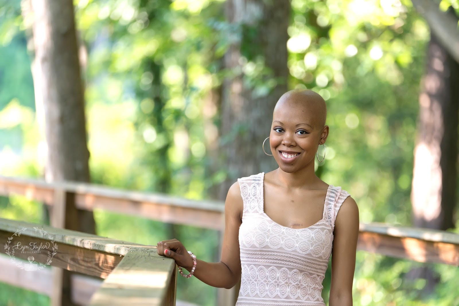 Bald Is Beautiful Campaign