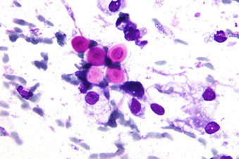 Clash of the titan- Survival strategy for Cryptococcus