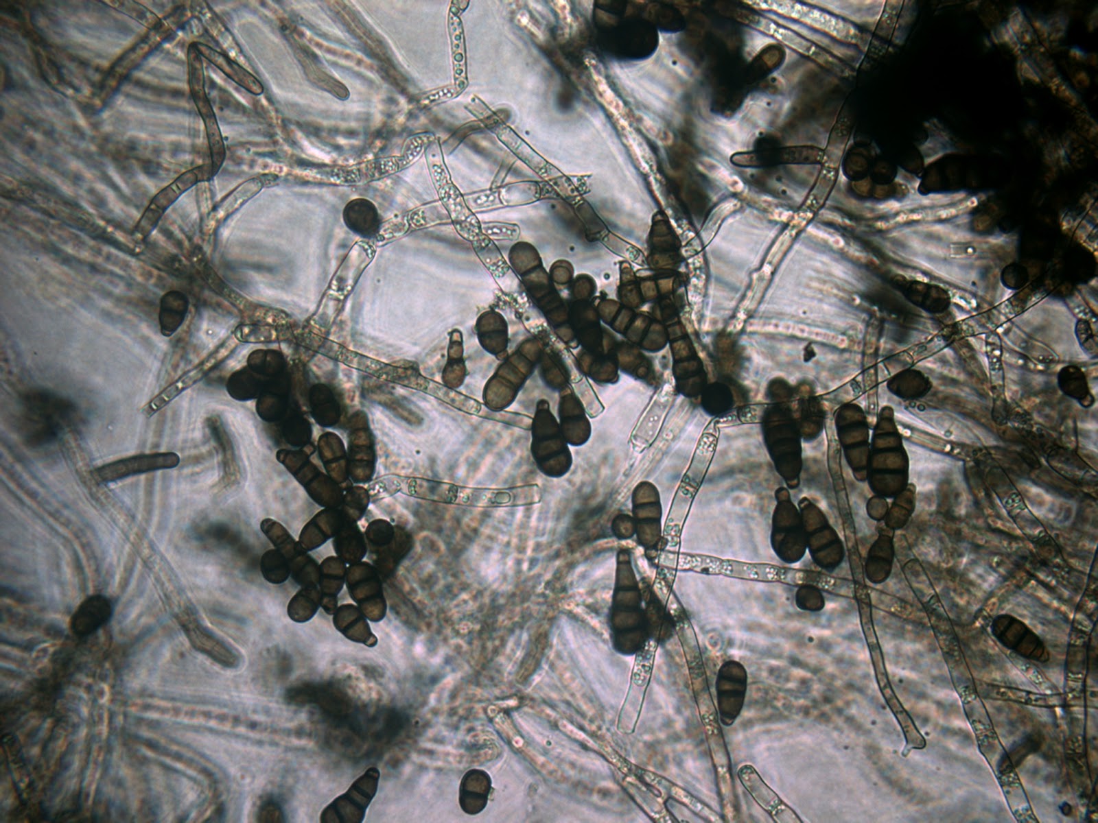 MaxwellHandiseniPLPA631: Lab 5: Conidiating Fungi
