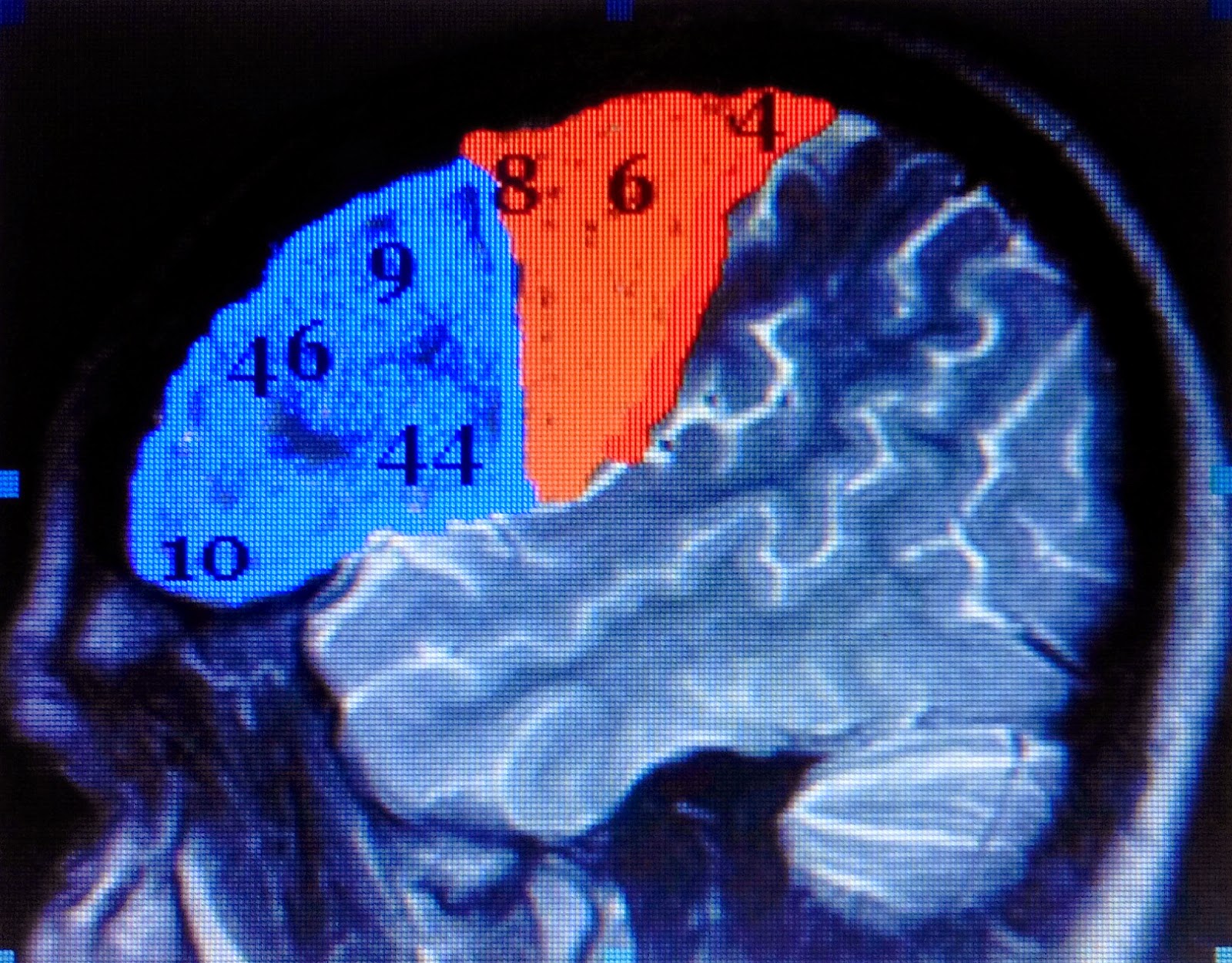 Neuropsicología: Metodós de Luria - Unidades Funcionales