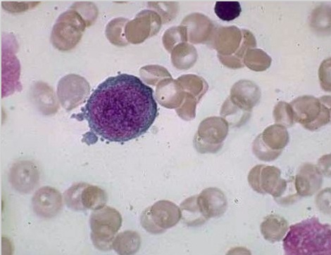 fichero de Hematologia