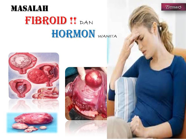 FIRMAX3 beauty: Masalah Fibroid Dan Hormon Wanita