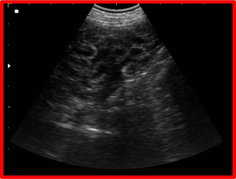 Veterinária Adriana Meirelles: Dioctophyma renale, o verme gigante dos rins
