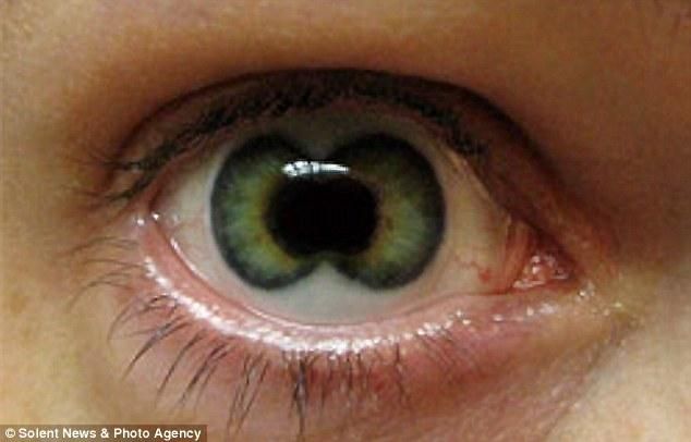 10 strange contact lenses | Odd Bizarre