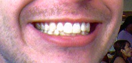 LifeOver35: April 2011