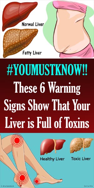 These 6 Warning Signs Show That Your Liver Is Full Of Toxins