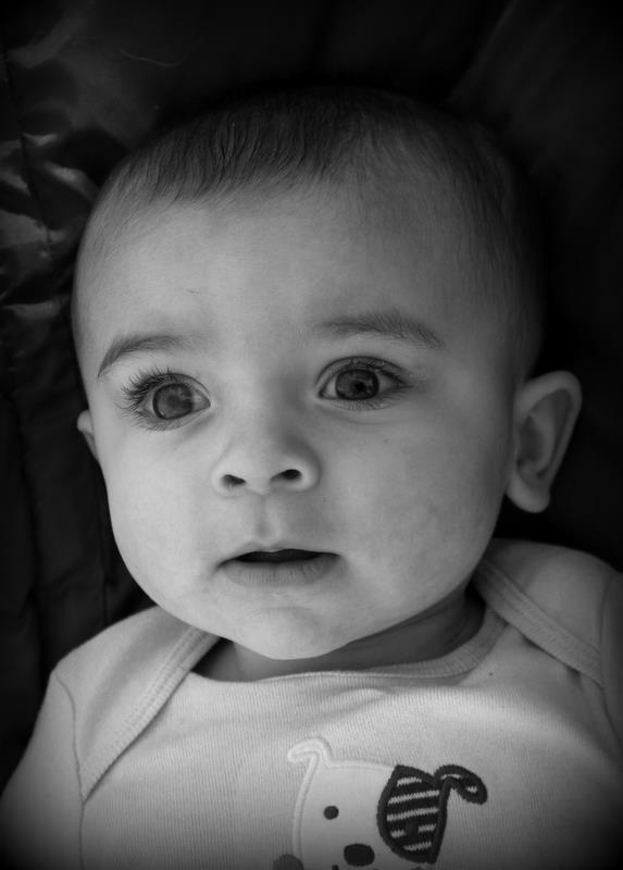 Busy Momma of Three: In 8 Hours Quinn Will Have One Eye