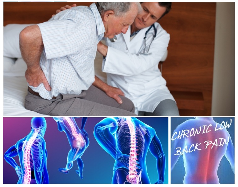 CHRONIC LOW BACK PAIN: The Lower Back Structures and Treatment Approach