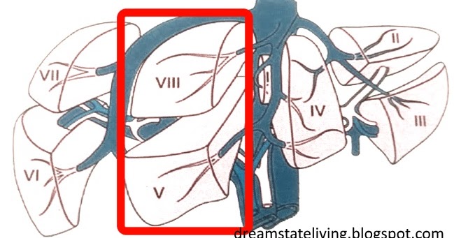 Dreamstate Living: Liver cancer, surgery