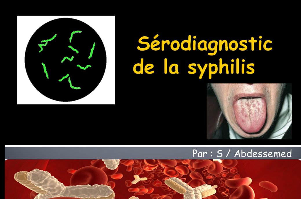 Sérodiagnostic de la syphilis - SVTPlus