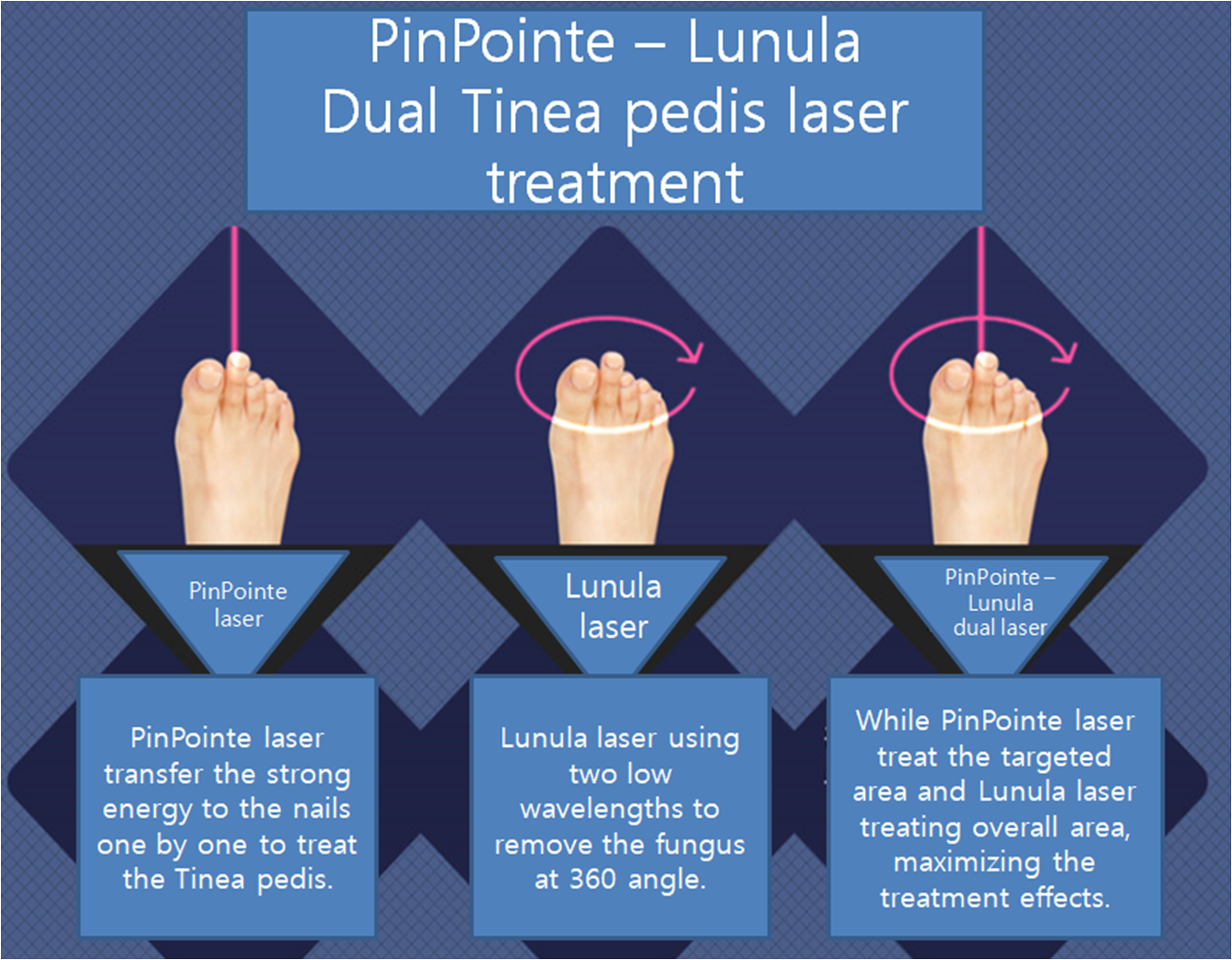 Renewme Skin Clinic: Tinea pedis treatment review