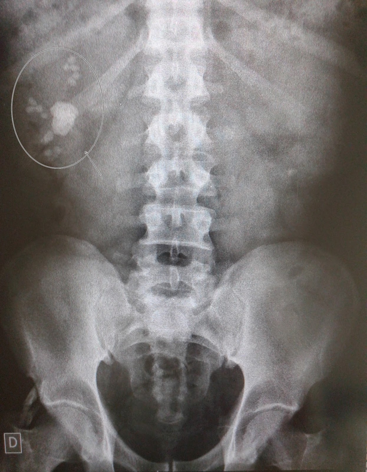 DICAS DE RADIOLOGIA - Tudo Sobre Radiologia: IMAGENS RADIOLÓGICAS ...