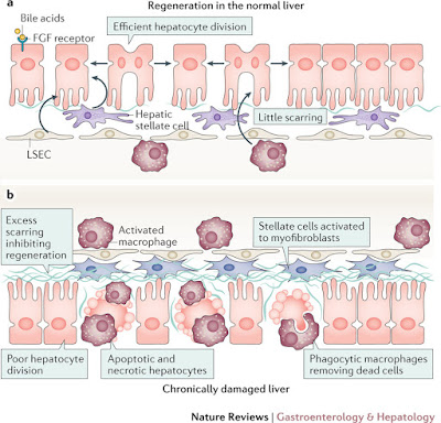 Figure 2: Schematic of normal and abnormal liver regeneration.