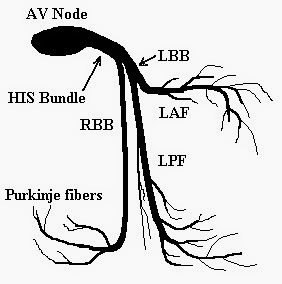 Left Posterior Fascicular Block | INA - ECG