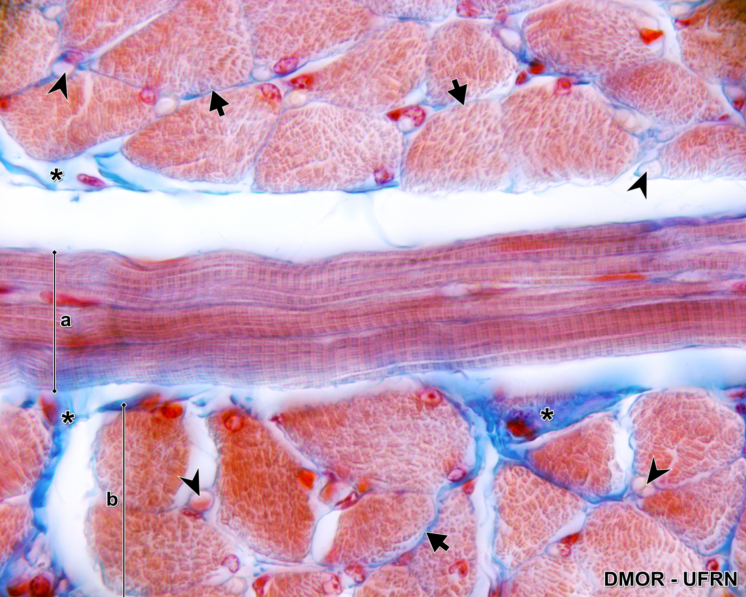 Ciências Morfológicas - UFRN: Tecido Muscular
