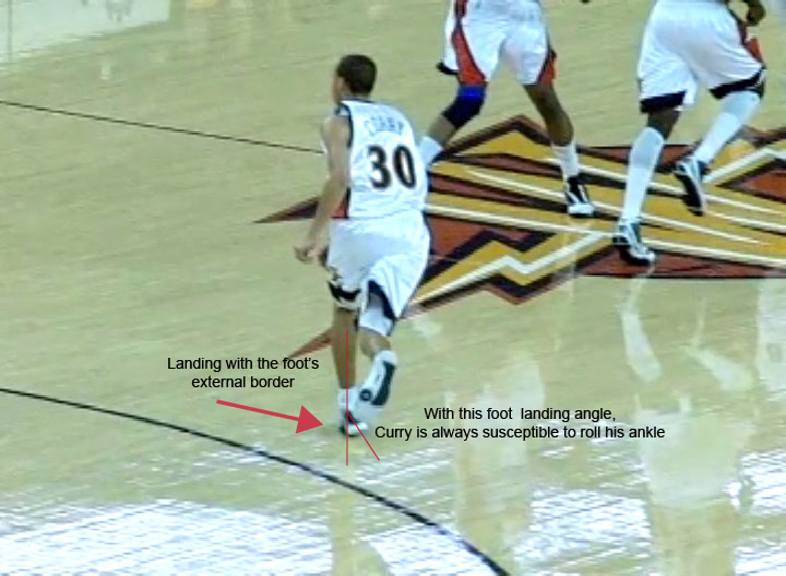 Stephen Curry, Ankle Injuries Analysis