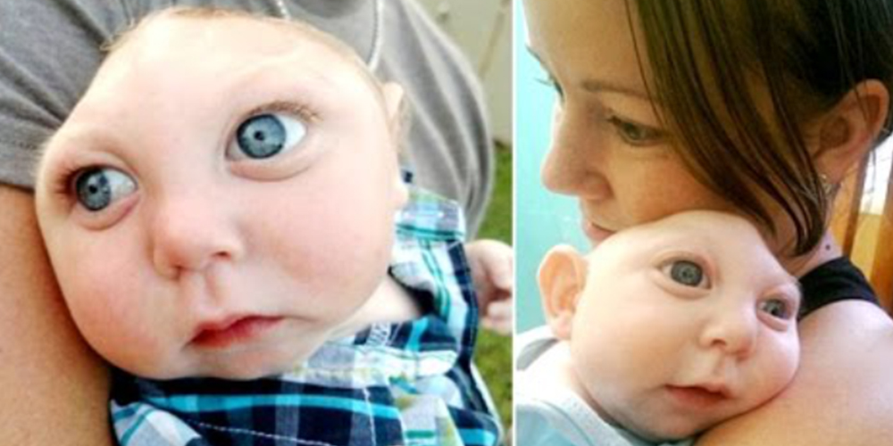 Baby born with part of his brain and skull missing | Life With Styles