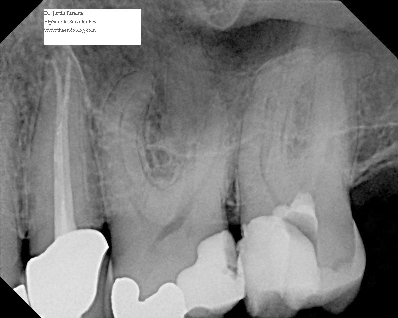 AJIDS e - Library.: A look into the clinical practice of endodontics.