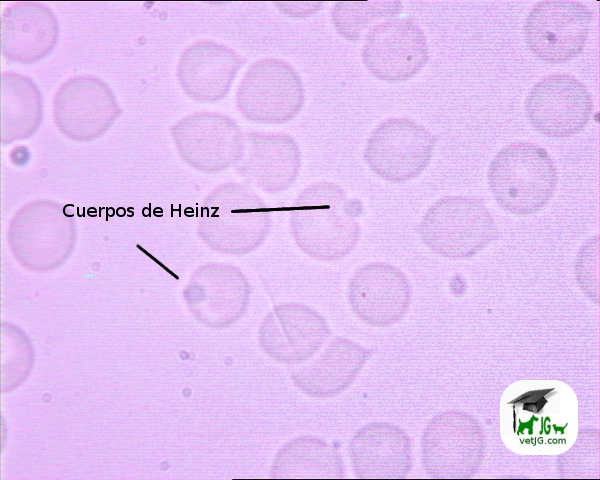 Prácticas Hematología. : Detección de cuerpos de Heinz