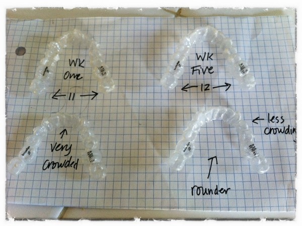 September 2012 ~ Tina Reed Orthodontics