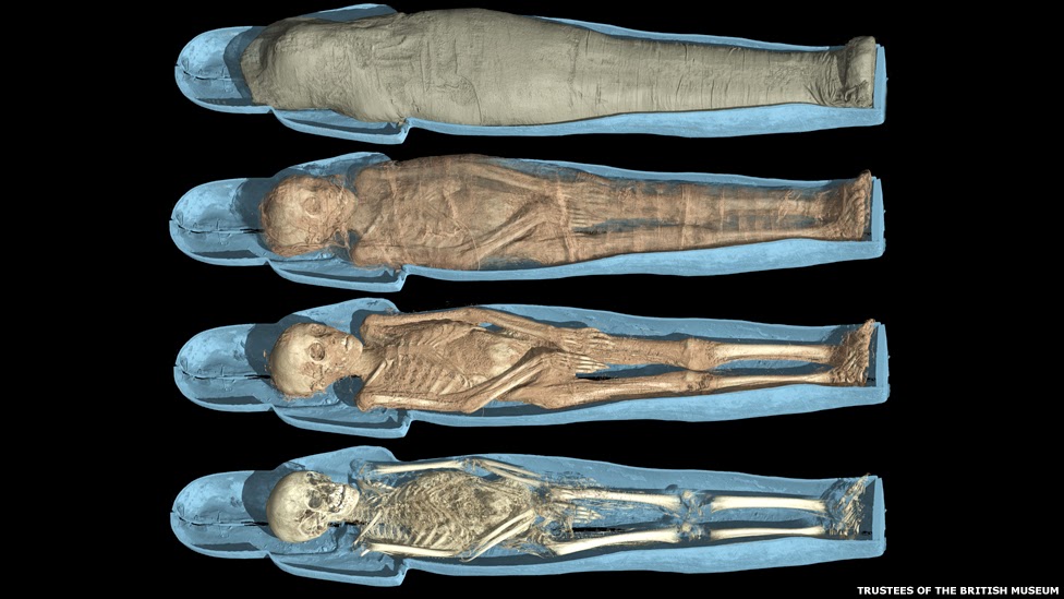 Ancient Mummies Gallery - CT scans of mummies
