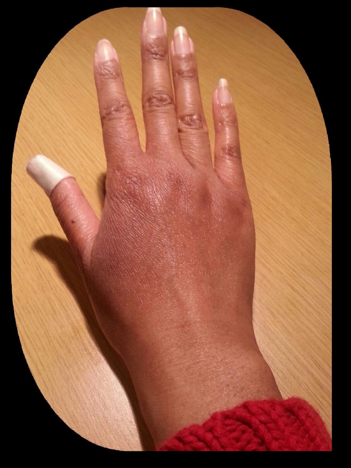 Living It Up Alternatively: DRY CRACKED HANDS?