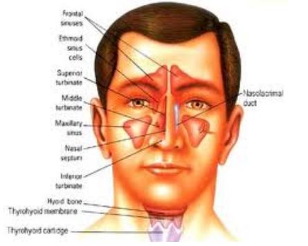 Reproductive Health and Fetal: TYPE nasal polyps