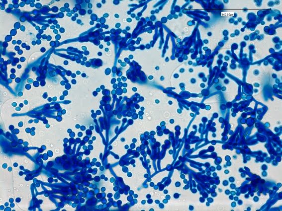 Fun With Microbiology (What's Buggin' You?): Scopulariopsis brevicaulis