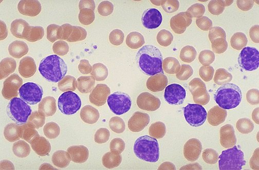 VETERINARY HEMATOLOGY DEXTERVET: mature lymphocytes they are indicative ...