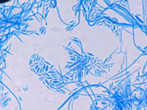 Microbiología y Epidemiología: Fusarium sp.